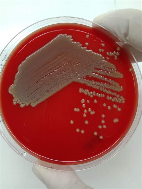 𝑺𝒕𝒆𝒏𝒐𝒕𝒓𝒐𝒑𝒉𝒐𝒎𝒐𝒏𝒂𝒔 𝒎𝒂𝒍𝒕𝒐𝒑𝒉𝒊𝒍𝒊𝒂 𝗠𝗲𝗱𝗶𝗰𝗮𝗹 𝗠𝗶𝗰𝗿𝗼𝗯𝗶𝗼𝗹𝗼𝗴𝘆🔬🧫 Sijo Asokan