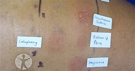 Patch Test Image