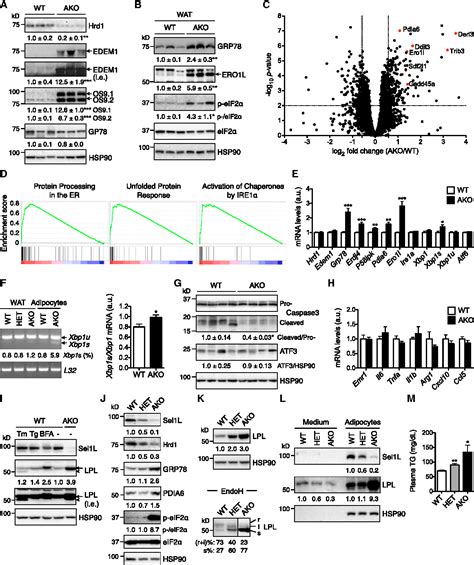 Figure 4 From The Er Associated Degradation Adaptor Protein Sel1l Regulates Lpl Secretion And