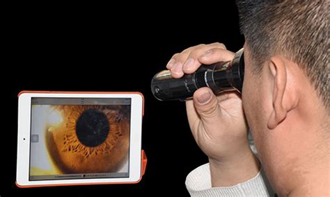 Iris Microscope With Perfect Quality Distrbutor Price