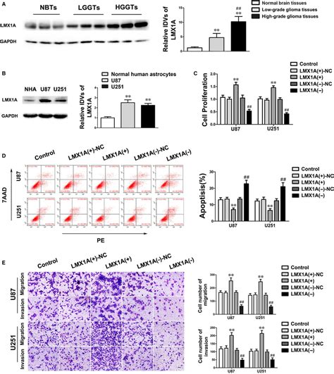 LMX1A Was Upregulated And Exerted Cancerogenic Functions In Glioma Download Scientific