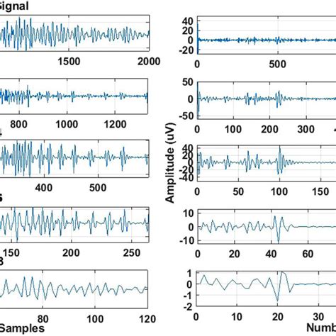 Proposed Methodology For The Classification Of Mi Eeg Signals