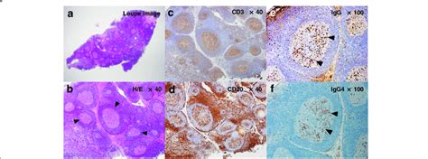 A B Histopathological Specimens Revealed Lymphatic Follicles Download Scientific Diagram