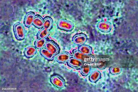 Pneumococcus Pneumococcus Is A Bacteria Involved In Pneumonia