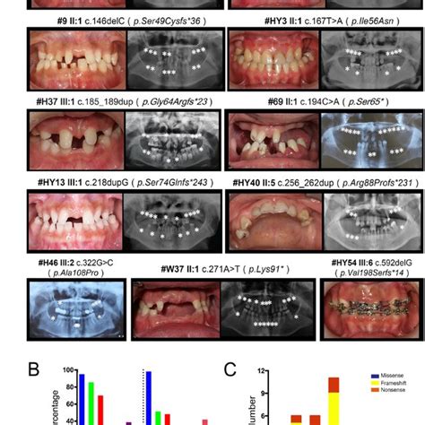 Pdf Nine Novel Pax9 Mutations And A Distinct Tooth Agenesis Genotype