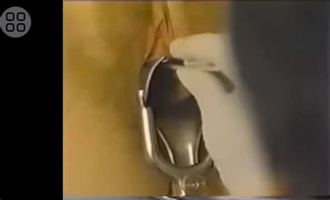 Pelvic Exam Training Video