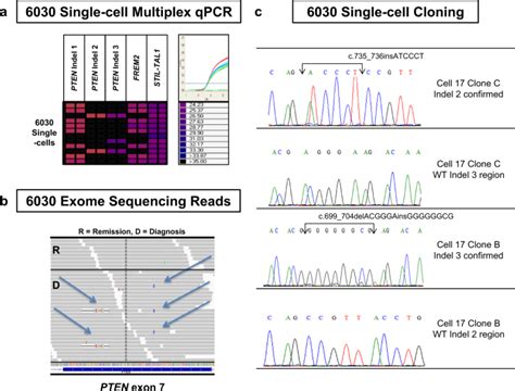 The Subclonal Complexity Of Stil Tal1 T Cell Acute Lymphoblastic Leukaemia Pmc