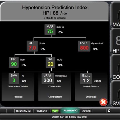 Conceptual Framework For The Hemodynamic Management HPI Hypotension Download Scientific
