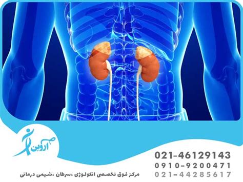 سرطان غدد فوق کلیوی سرطان غدد فوق کلیوی چیست کلینیک آروین