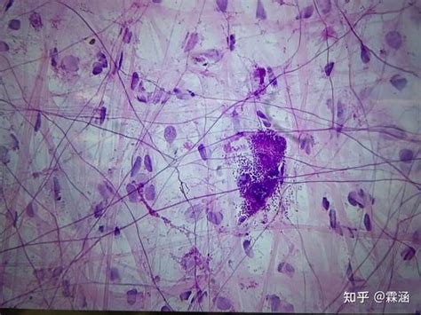 组胚学习笔记：结缔组织 知乎