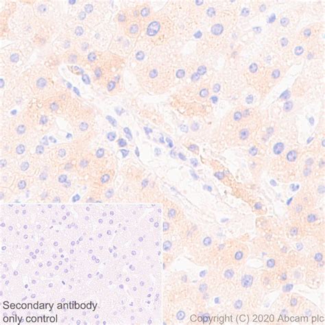 Anti Complement Factor 8 Beta C8b 抗体 [epr23764 1] Ab278045 Abcam