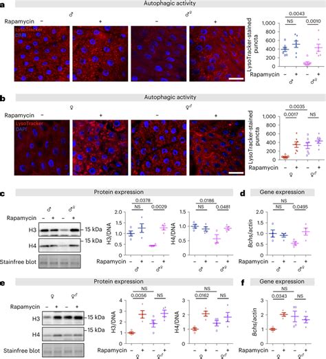 Cell Autonomous Sexual Identity In Enterocytes Dictates The Levels Of