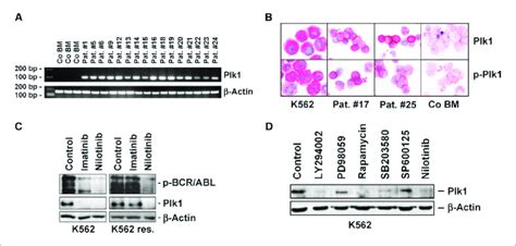 Plk1 Is Expressed In Cml Cells In A Bcrabl Dependent Manner A Rt Pcr Download Scientific