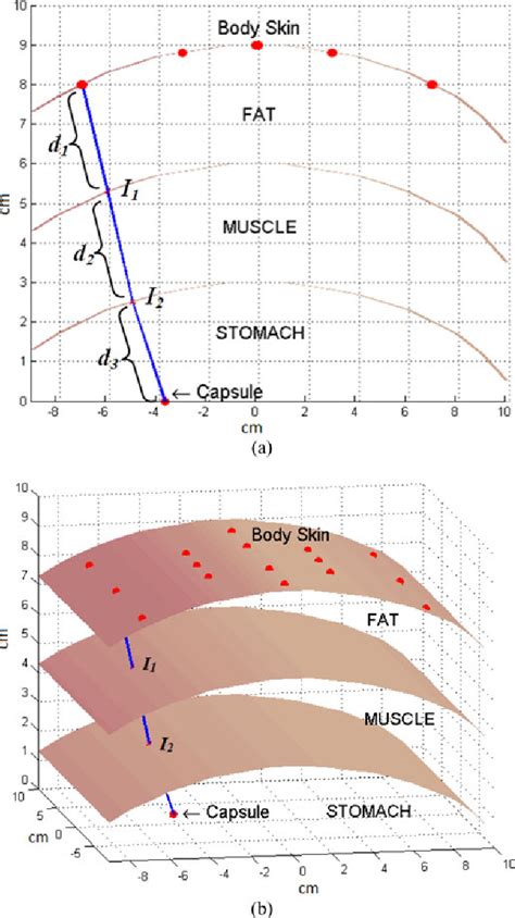 figure 3 from accurate localization of in body medical implants based