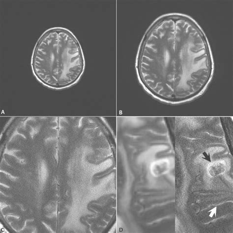 Image Resolution Pixel And Voxel Size Radiology Key