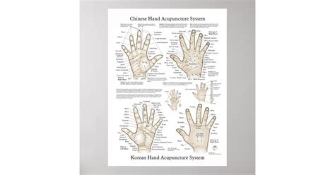 Hand Acupuncture Points Therapy Poster Zazzle