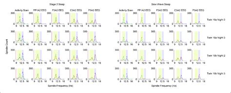 Figure 1 From Automatic Sleep Spindle Detection And Genetic Influence