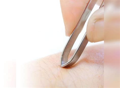 عسلنا عفونت موی زیر پوستی از علل تا درمان های خانگی و دارویی عفونت