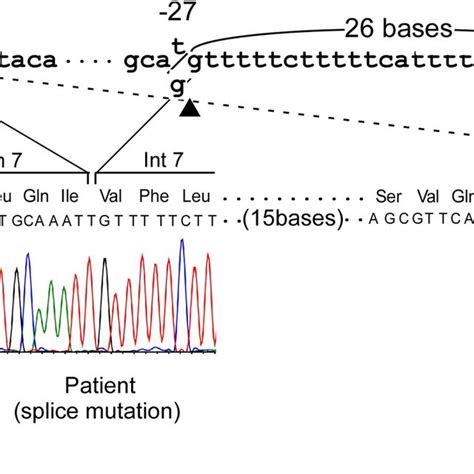 a detection of minor transcript using a new 3 splice site in the