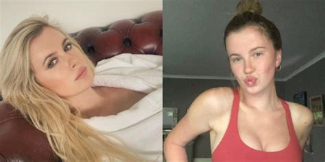 The Model Decided To Clearly Show How She Really Looks In The Photo Without Editing And Filters