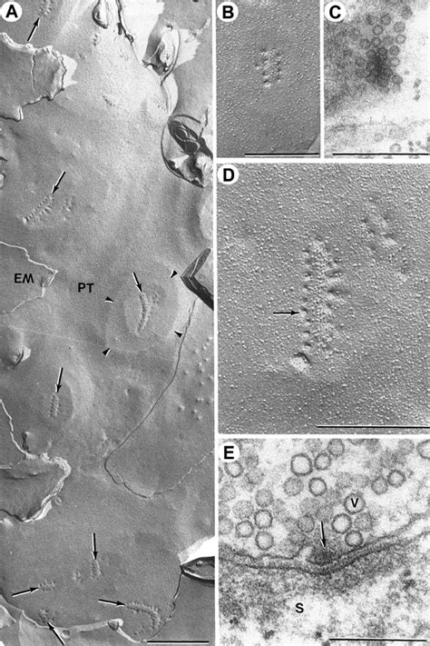 14 Organization Of Excitor Synapses And Their Active Zones In The Download Scientific Diagram