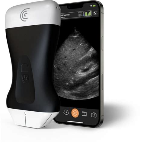 Wireless Ultrasound For Hospitalists Clarius High Definition Wireless