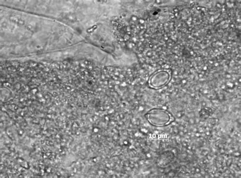 What Kind Of Microfossil It Is