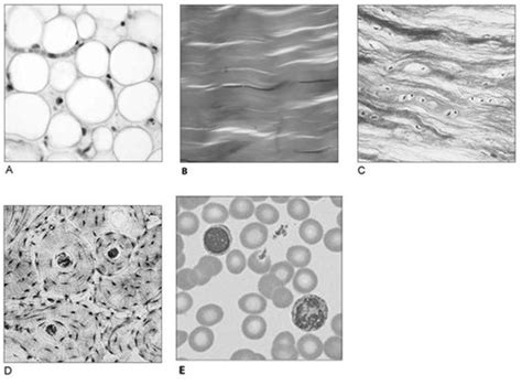 Lab Assignment 8 Flashcards Quizlet