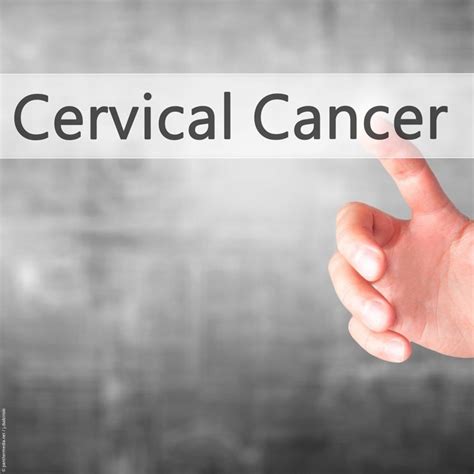 Revolutionizing Cervical Cancer Screening Using Artificial Intelligence Innovation Toronto