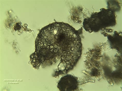 Tecameba Difflugia Urceolata O Lobostoma Ingrandimento 400 Nematos Flickr