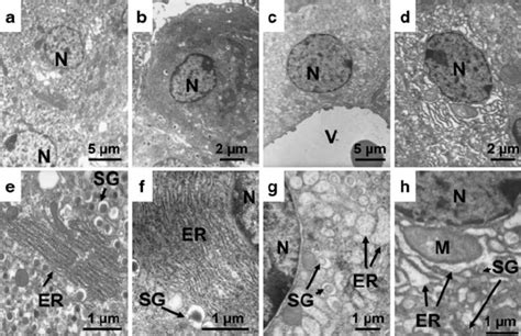 Electron Micrograph Of Pancreatic Beta Cells Ultrastructural Analysis