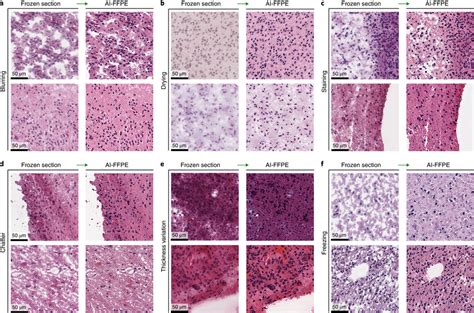 Improvement Of Artefacts In The Brain Frozen Sections Examples Of