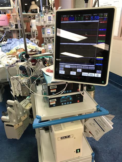 Innovative Ecmo Concepts Inc On Linkedin The Centrimag And Pedimag
