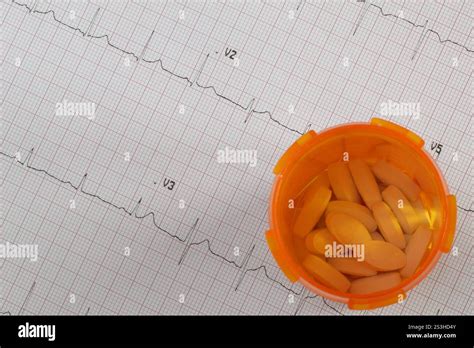 Electrocardiogram Ecg Ekg Printed Report Graph With Medication Stock