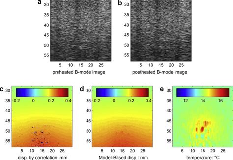 temperature estimation using the model based outlier removal algorithm