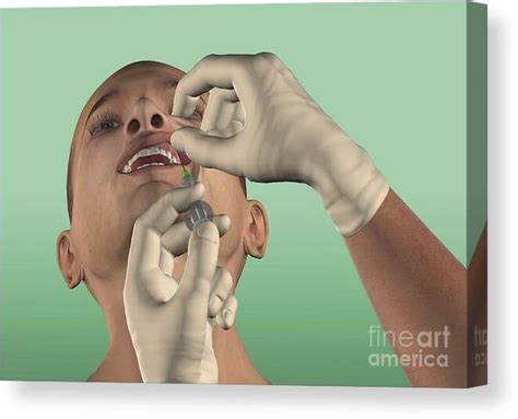 Infraorbital Nerve Block