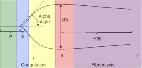 Resus Thromboelastography Teg In Trauma Resuscitation — University Hospitals Emergency
