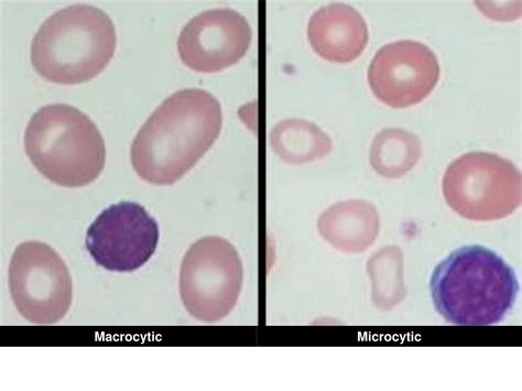 Ppt Red Blood Cells Powerpoint Presentation Free Download Id745427