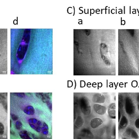 Multimodal Imaging Of Transverse Perpendicular Sections Of Cartilage Download Scientific