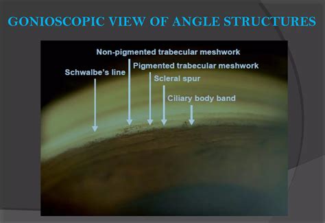 Gonioscopy Ppt