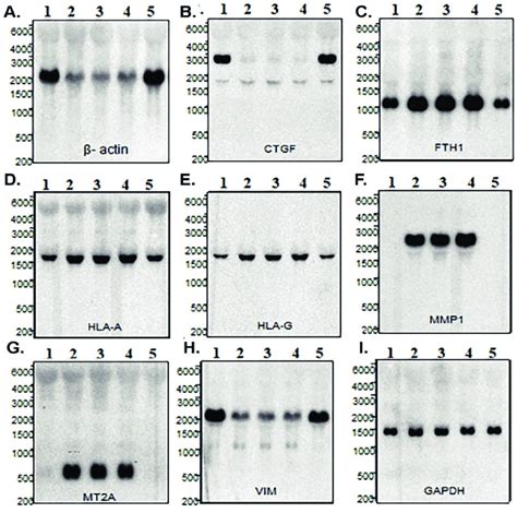 Microarray Data Validation Using Northern Blot Analysis 10 μg Of Total