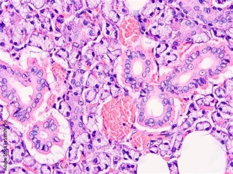 Histology Of Human Tissue Show Epithelial Tissue And Connective Tissue