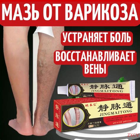 Китайская мазь от варикоза вен на ногах Джинг Май Тонг - купить с ...