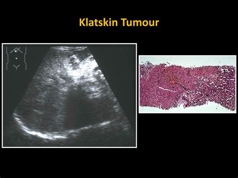 Assessing Biliary Pathology Ppt Download