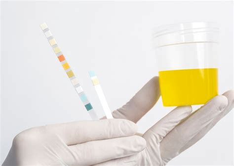 Understanding The Benefits Of Home Based Urine Testing For Health