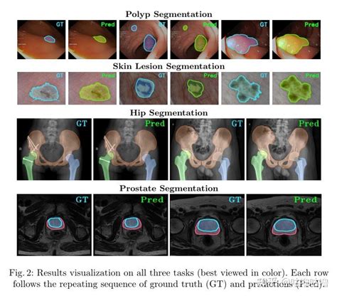 学习 Transfuse Fusing Transformers And Cnns For Medical Image