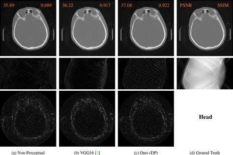 Figure From Step Sparse View CT Reconstruction With A Domain Specific Perceptual Network