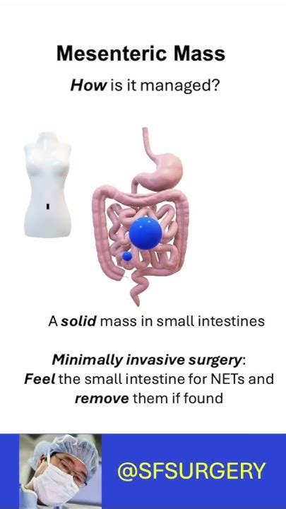 Mesenteric Mass Management Surgical Management Of Mesenteric Mass Of