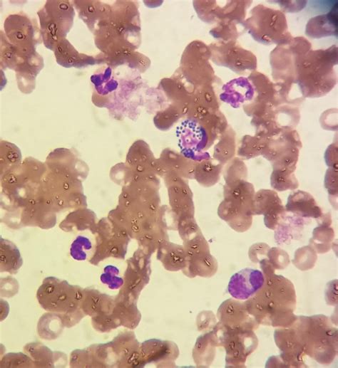 Saw An Elusive Basophil The Other Day So Pretty Rveterinary