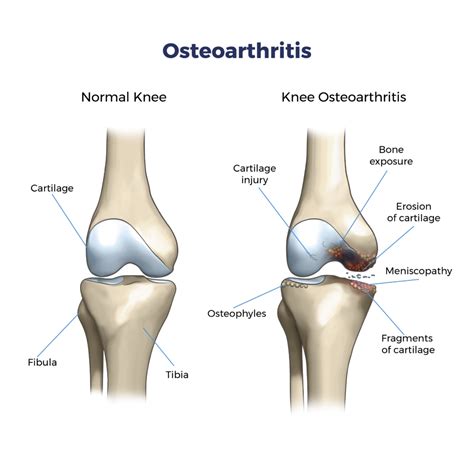 Conditions We Treat Arvcenters
